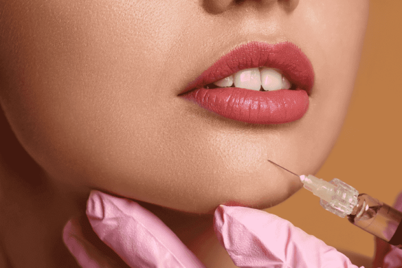 Chin Filler Longevity: How Long Will It Last?